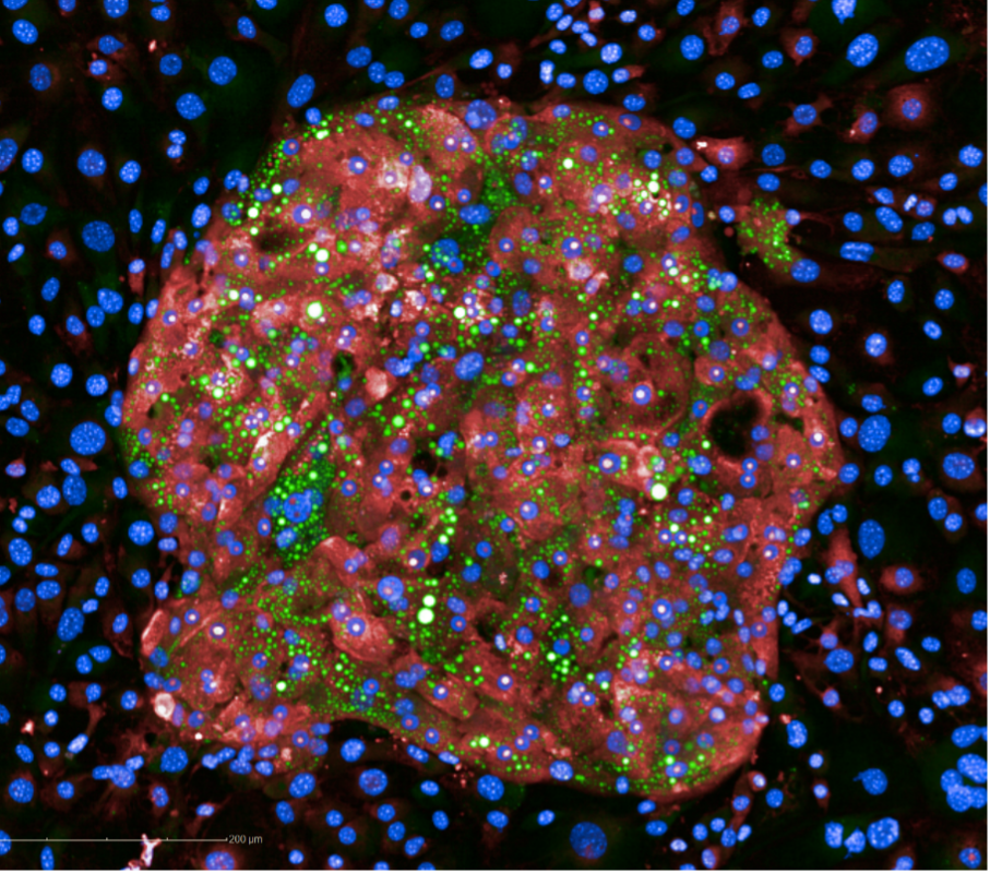 High Content Imaging Delivers the Best Results for Microscopy - ScitoVation