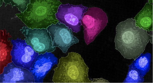 High Content Imaging Delivers the Best Results for Microscopy - ScitoVation